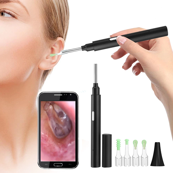 Smart Visual Ear Wax Removal Tool